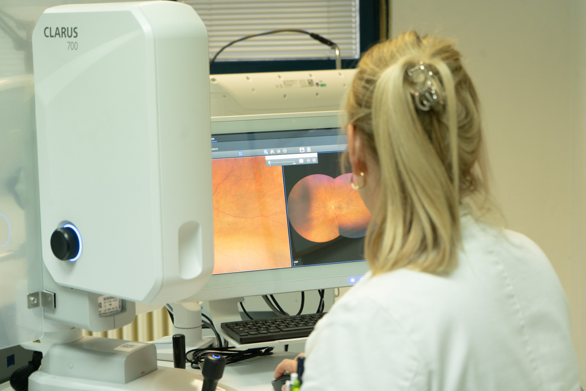 OB Zadar nabavila nove aparate za još preciznije liječenje bolesti oka ...